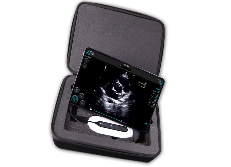 Discuss how the marketing strategy of handheld ultrasound machines sho ...