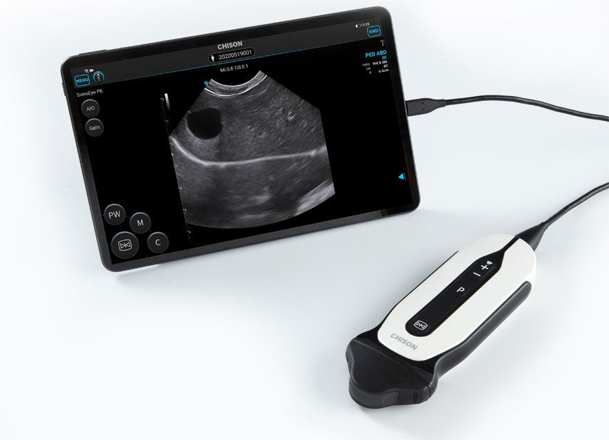 The Handheld Color Doppler Ultrasound SonoEye P6: A Portable Diagnosti ...