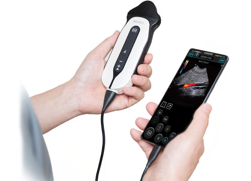 Chison handheld veterinary color ultrasound: a powerful assistant for ...
