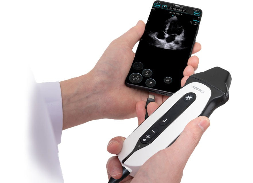The Handheld Digital Doppler Ultrasound: Chison SonoEye P3 – CHISON ...