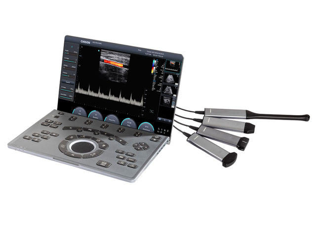 portable ultrasound probe-chison about us – CHISON Ultrasound